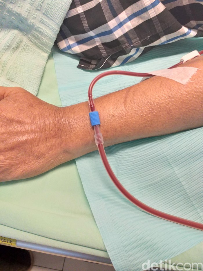 Mengenal Alat Cuci Darah yang 'Selangnya' Sempat Jadi Heboh