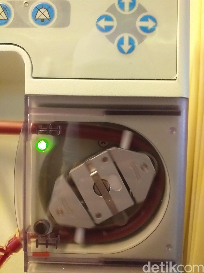 Mengenal Alat Cuci Darah yang 'Selangnya' Sempat Jadi Heboh