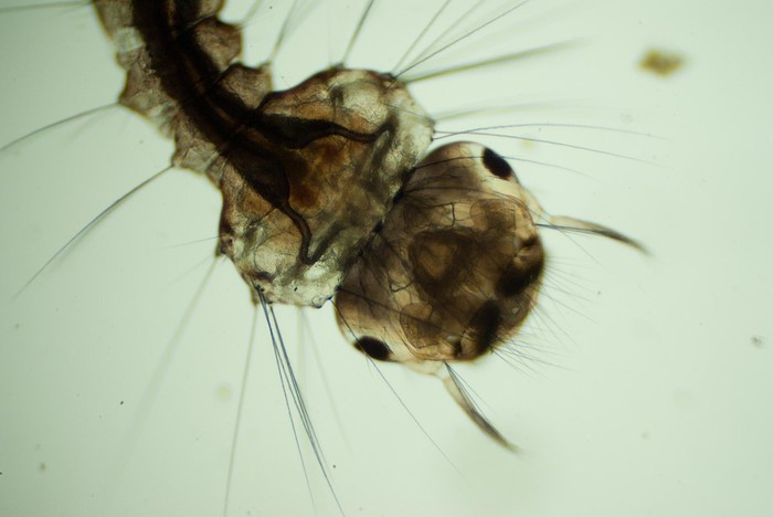 Penampakan Jentik Nyamuk di Bawah Mikroskop