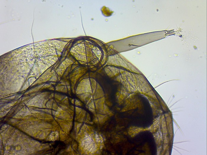 Penampakan Jentik Nyamuk di Bawah Mikroskop