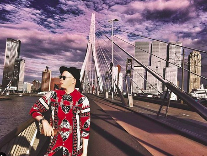 Potret Liburannya Model Albino, Sanele Junior Xaba