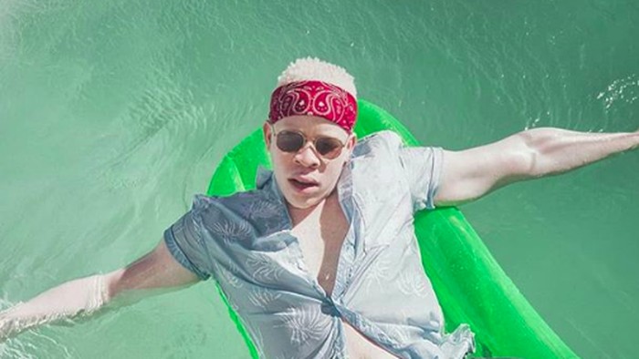 Potret Liburannya Model Albino, Sanele Junior Xaba