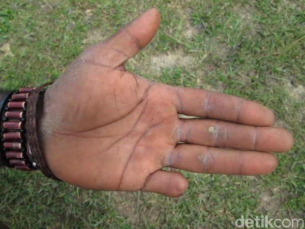 Foto: Tradisi Bakar Jenazah dan Potong Jari Papua