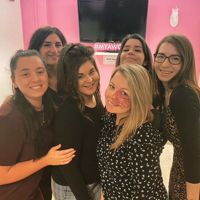 Potret Wanita dengan Tanda Lahir di Wajah, Kini PD Tampil Tanpa Makeup