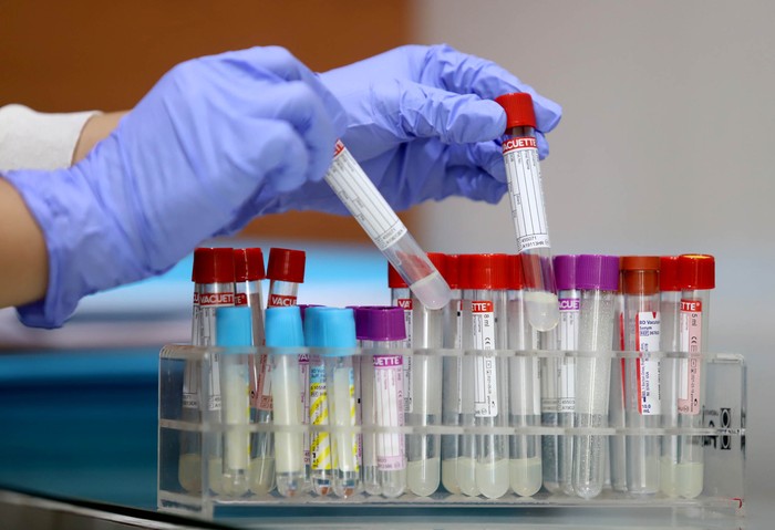Test PCR Deteksi 3 Gen Sekaligus