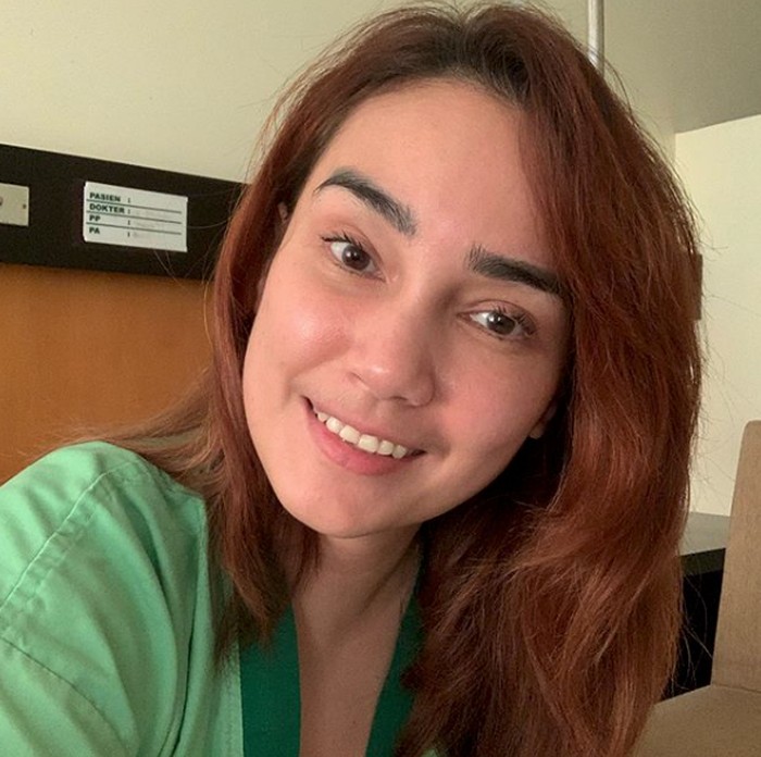 Feby Febiola Idap Kanker, Rambut Panjang Jadi Bondol Tapi Tetap Senyum