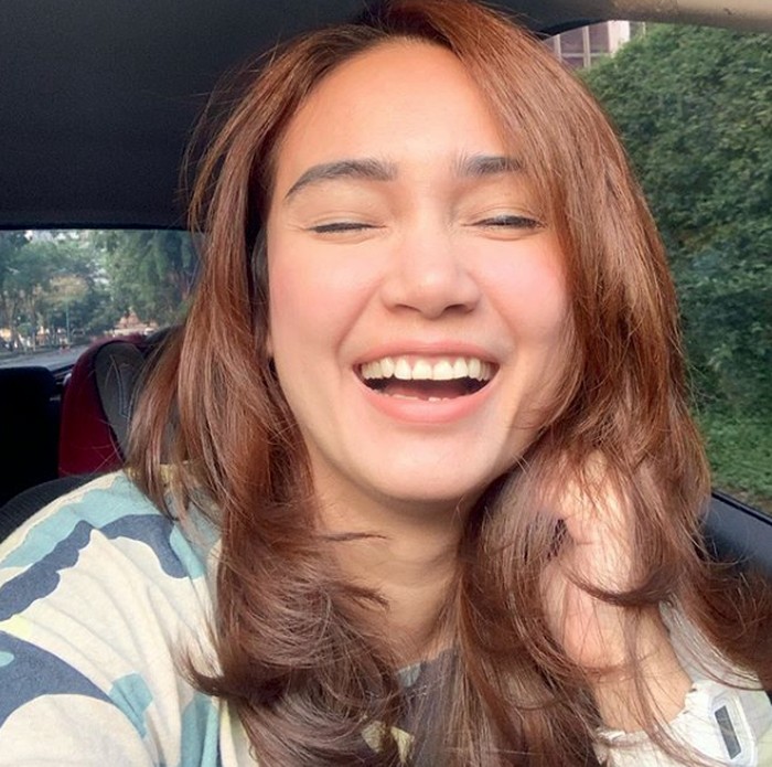 Feby Febiola Idap Kanker, Rambut Panjang Jadi Bondol Tapi Tetap Senyum