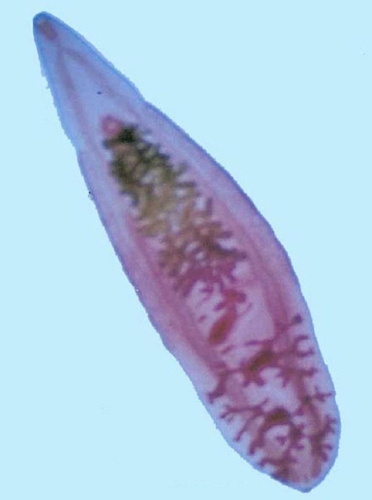 Waduh! Makan Ikan Mentah, Hati Pria Ini Digerogoti Cacing Waduh! Makan Ikan Mentah, Hati Pria Ini Digerogoti Cacing
