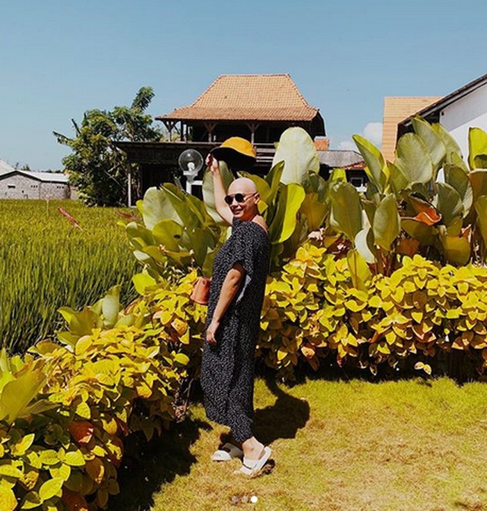 Potret Feby Febiola Cantik dengan Kepala Plontos