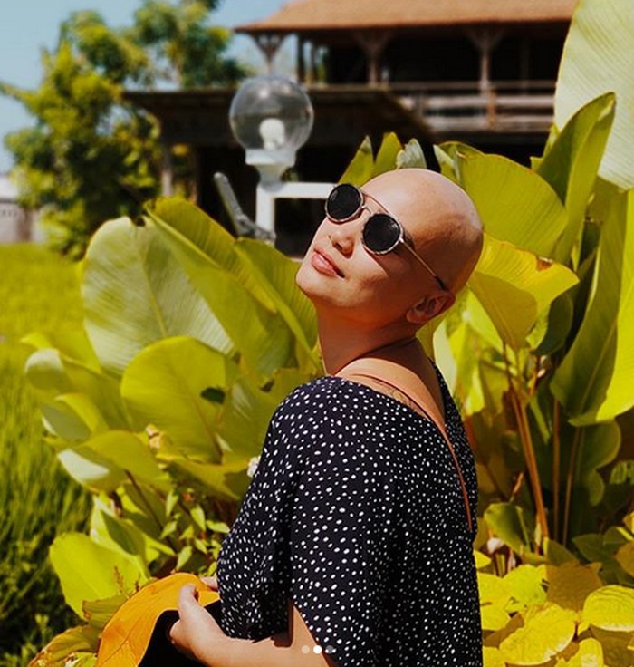 Potret Feby Febiola Cantik dengan Kepala Plontos