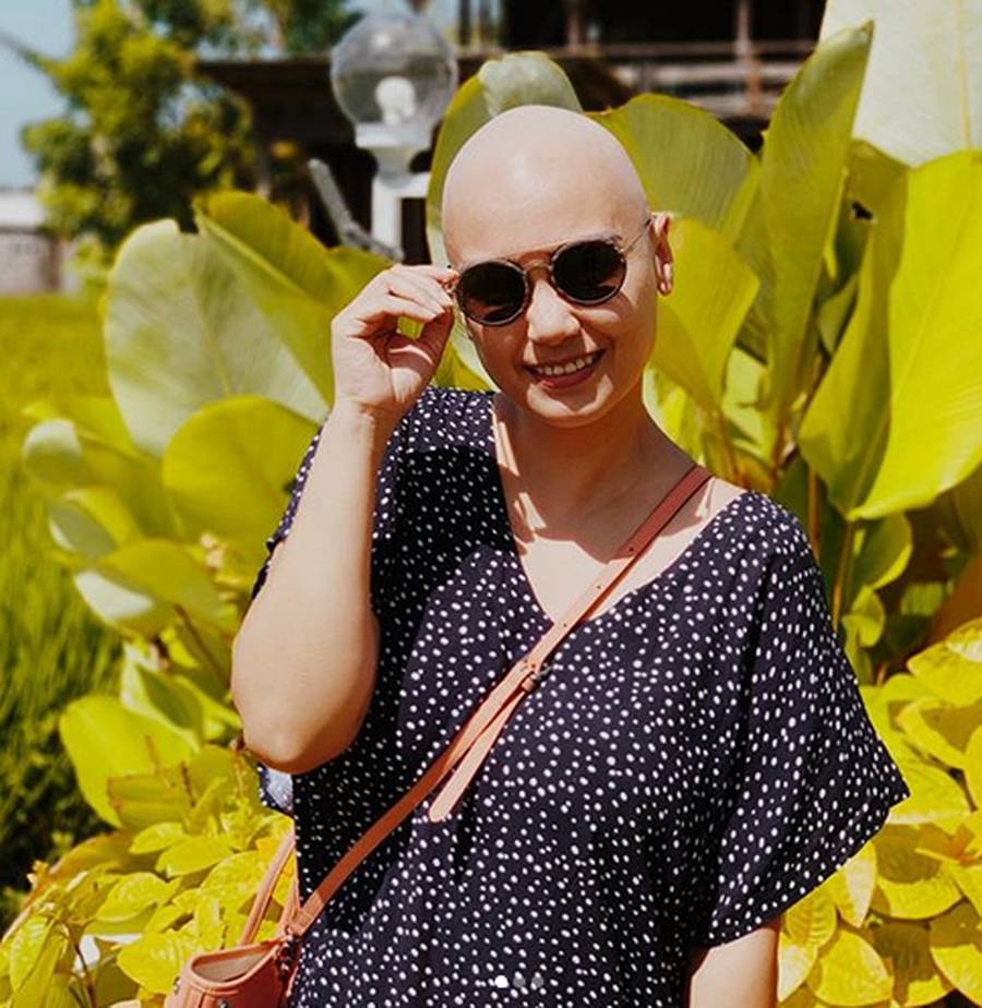 Potret Feby Febiola Cantik dengan Kepala Plontos