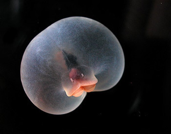 Foto: Cacing Unik Bernama Pantat Babi