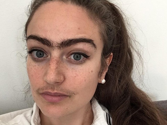 Curhat Wanita Punya Kumis & Alis Nyambung Mirip Pria, Sering Diteriaki ... Curhat Wanita Punya Kumis & Alis Nyambung Mirip Pria, Sering Diteriaki ...