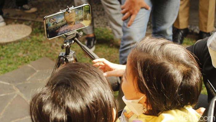 Kisah Bocah Kembar Siam Dempet Perut Asal Garut