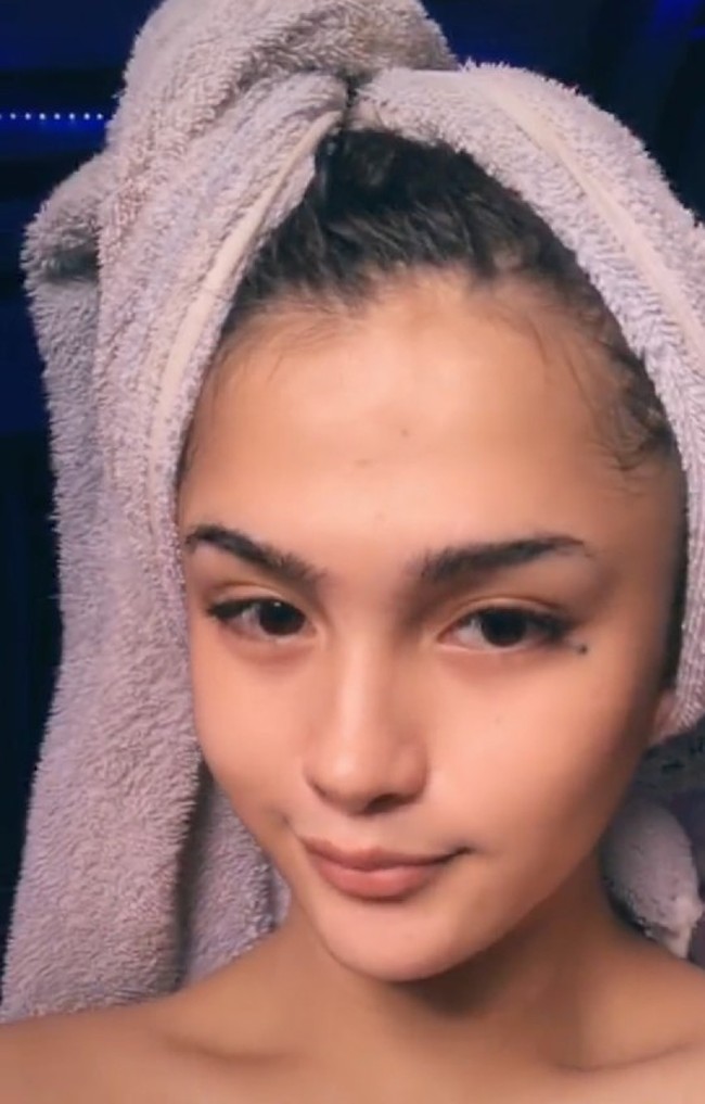 Kecantikan Wanita Ini Bikin Pria Terpesona, Tapi Foto Masa Lalunya Mengejutkan