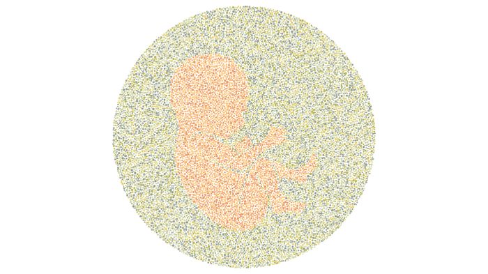 Uji Penglihatan, Cek Apakah Kamu Buta Warna dengan Menebak Gambar Ini