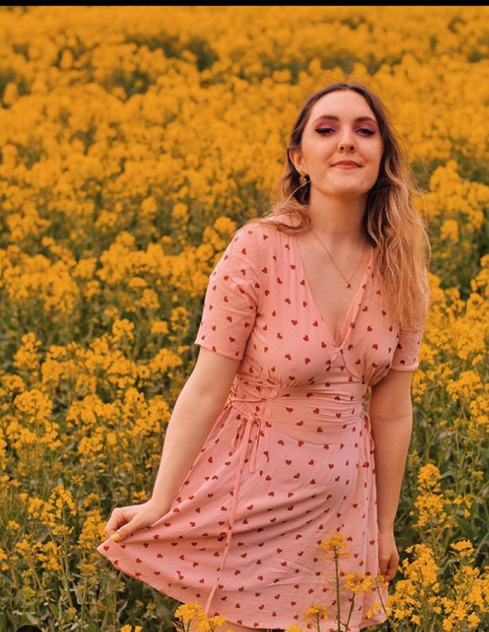 6 Foto Viral Wanita 25 Tahun Kena Penyakit Langka, Payudara Cuma Tumbuh ...