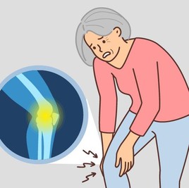 Hari Radang Sendi Sedunia, Yuk Kenali Gejala Osteoarthritis