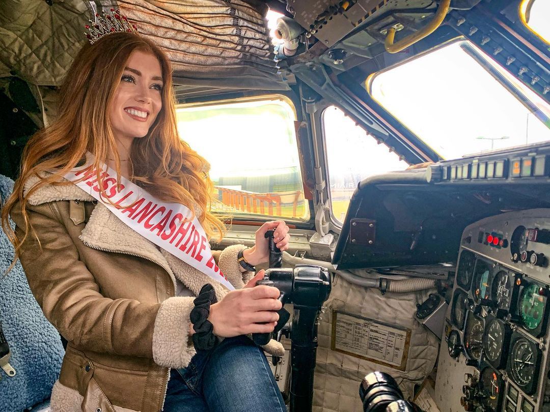 Dulu Sering Dibully, Wanita Ini Jadi Miss England Pertama yang Berambut ... Dulu Sering Dibully, Wanita Ini Jadi Miss England Pertama yang Berambut ...