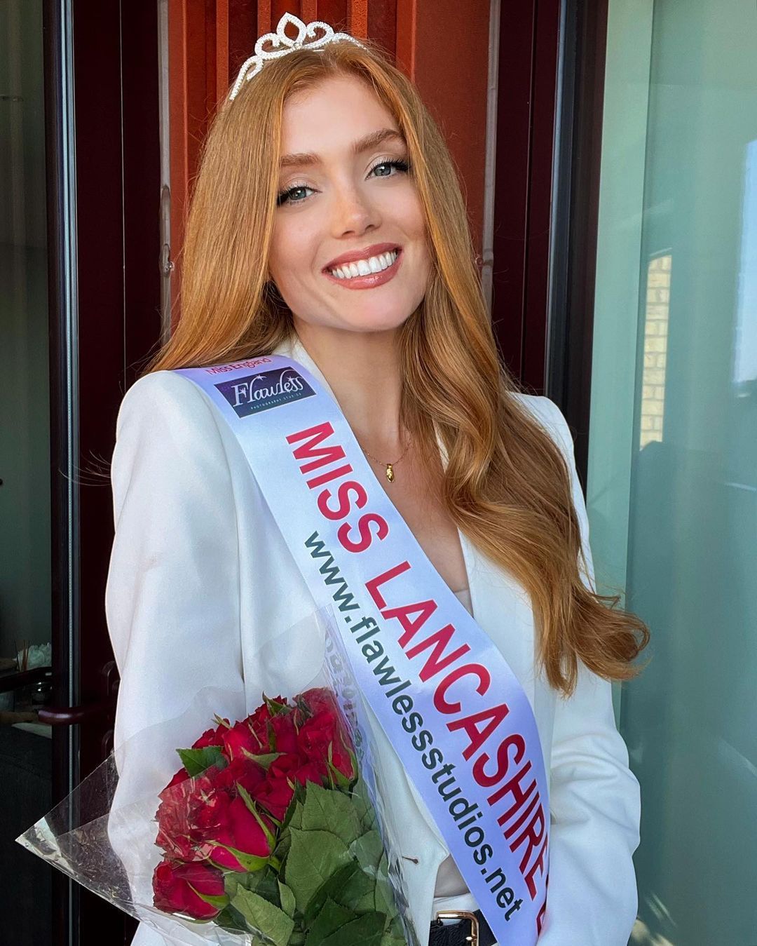 Dulu Sering Dibully, Wanita Ini Jadi Miss England Pertama yang Berambut ... Dulu Sering Dibully, Wanita Ini Jadi Miss England Pertama yang Berambut ...