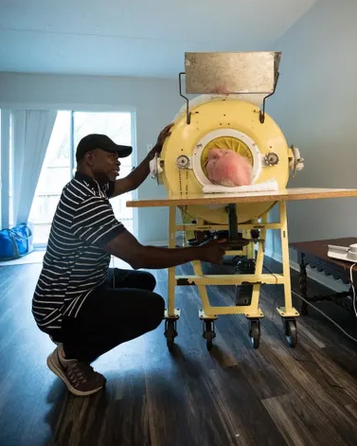 Foto Paul Alexander, Hidup dengan Paru-paru Besi Sejak Umur 6 Hingga Wafat