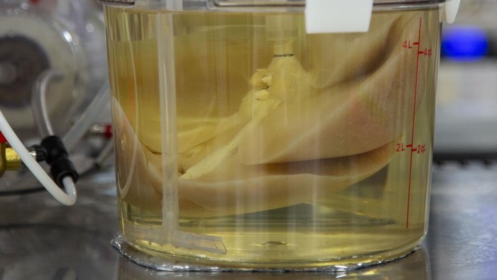 8 Foto Persiapan Ilmuwan Transplantasi Organ Hati-Ginjal Babi ke Manusia