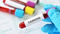 Gejala Leukemia, Jenis, dan Pencegahan untuk Menekan Risiko