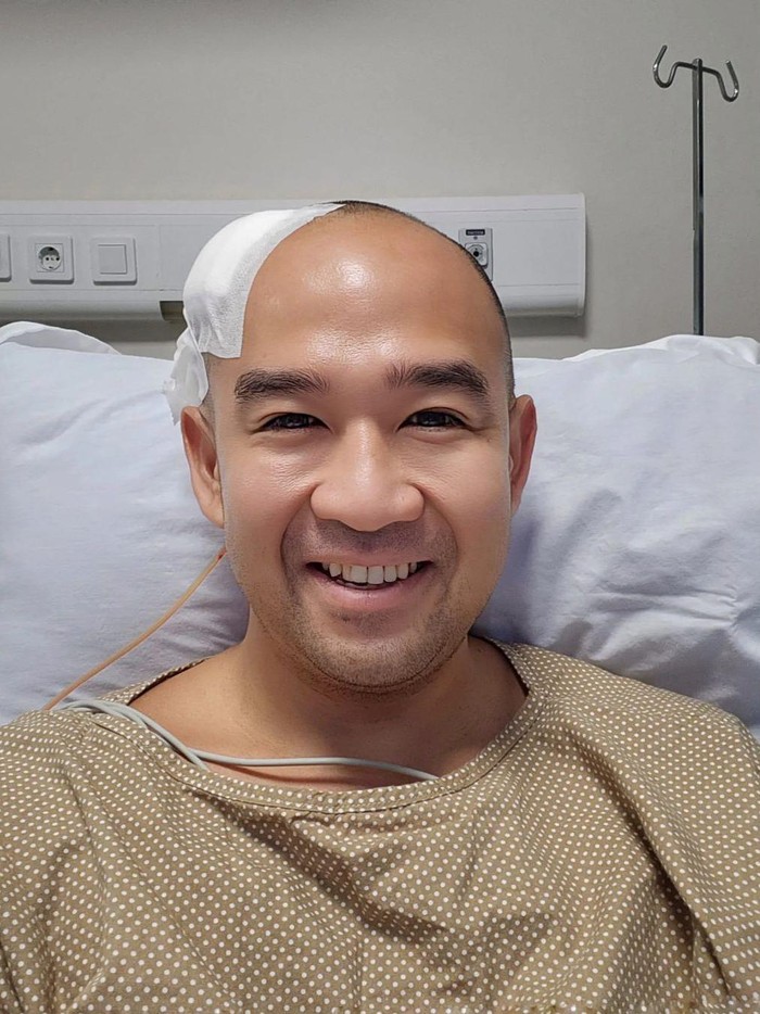 5 Potret Iwet Ramadhan Kabarkan Perdarahan Selaput Otak