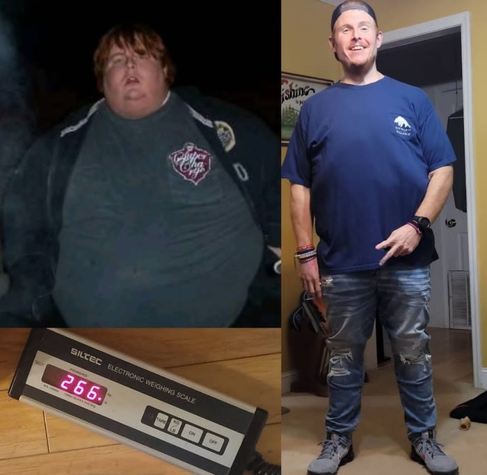 Before-After Casey King, Pria yang Sukses Pangkas BB hingga 272 kg