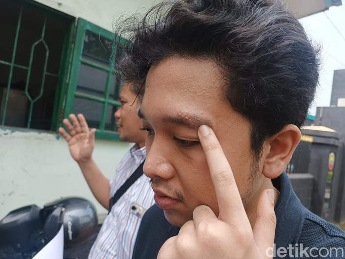 Taruna Akmil Diduga Aniaya Mahasiswa UISU Anak Kasat Narkoba Taruna Akmil Diduga Aniaya Mahasiswa UISU Anak Kasat Narkoba