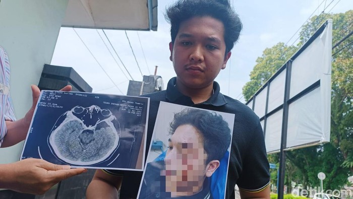 Babak Baru Kasus Taruna Akmil Diduga Aniaya Mahasiswa UISU Babak Baru Kasus Taruna Akmil Diduga Aniaya Mahasiswa UISU