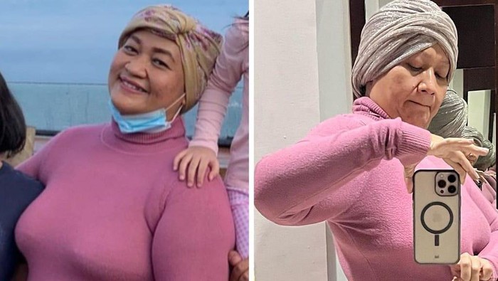 Before-After Tike Priatnakusuma, Intip Resep di Balik Sukses Pangkas BB ...