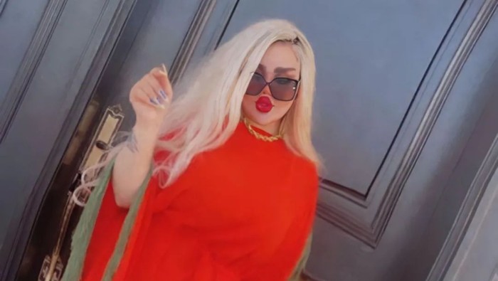 Potret Wanita Irak Rela Oplas 43 Kali demi Jadi Barbie di Dunia Nyata