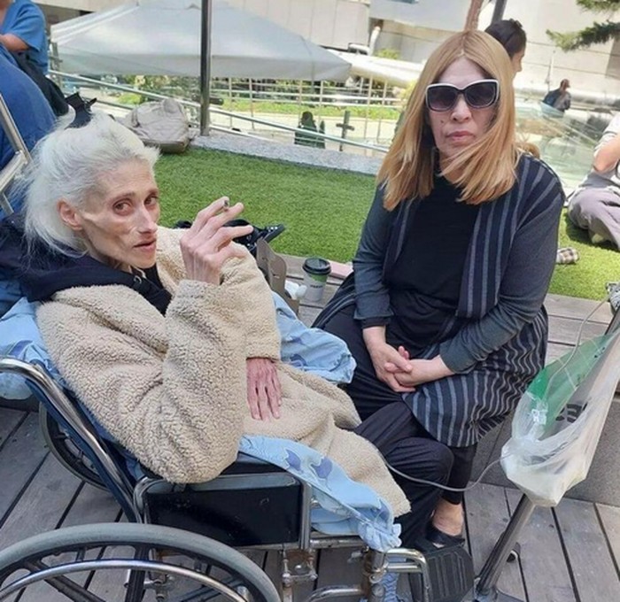 Model Anoreksia Meninggal Dunia, Beratnya Hanya 23 Kg