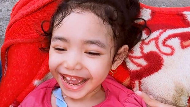 Nazila Bocah Yatim Piatu Alami Penyempitan Otak, Yuk Kita Bantu! Nazila Bocah Yatim Piatu Alami Penyempitan Otak, Yuk Kita Bantu!