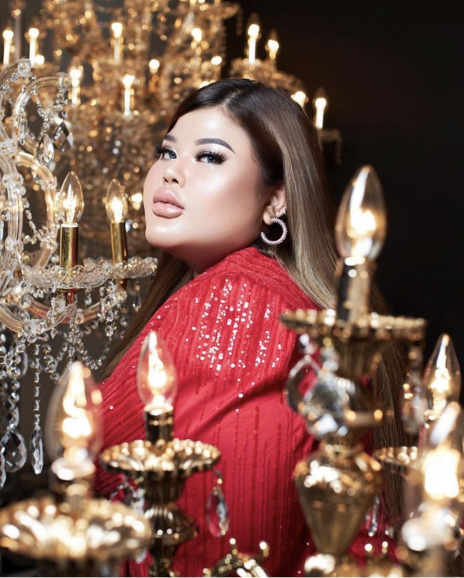 Foto Transformasi Shindy Samuel Usai Pengecilan Lambung, Dulu BB 155 Kg