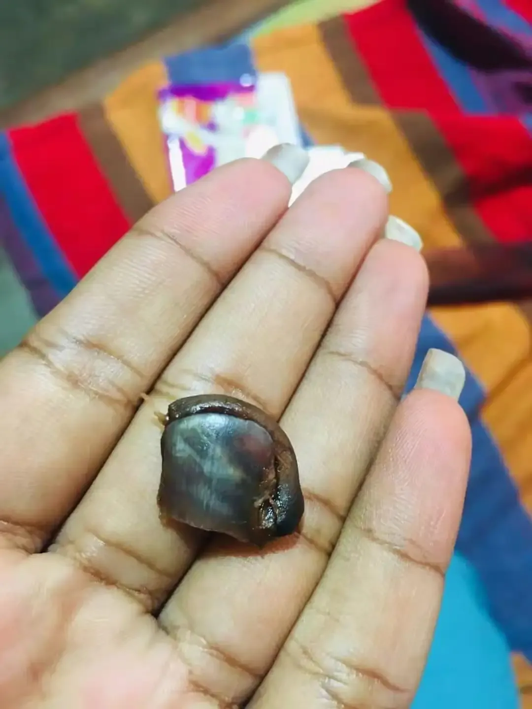 Uyanpol: Bikin Mual! Netizen Ini Temukan Potongan Jari Kaki Manusia di ... Uyanpol: Bikin Mual! Netizen Ini Temukan Potongan Jari Kaki Manusia di ...