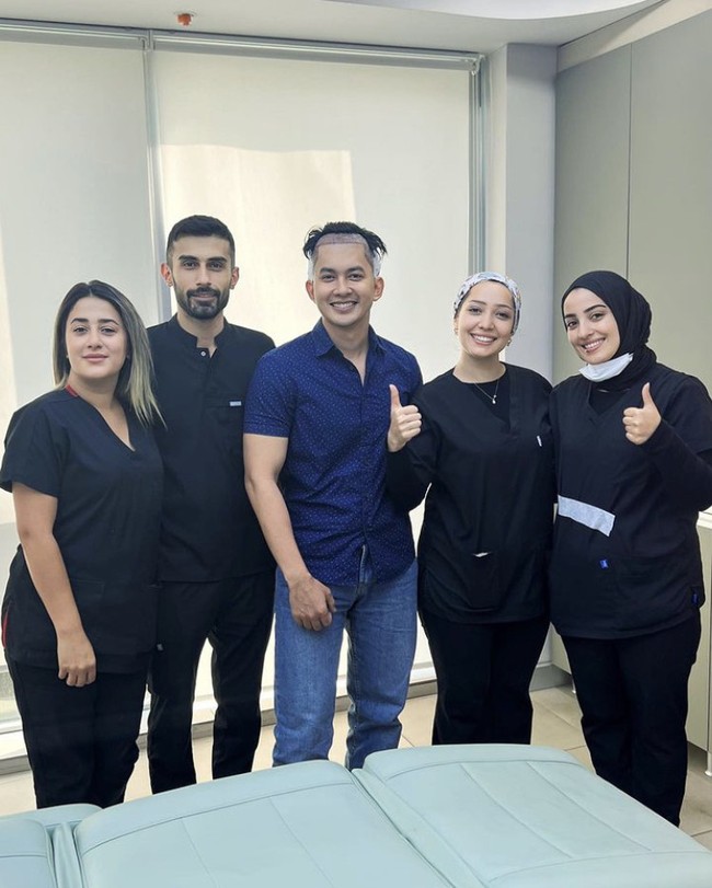 Foto 10 Artis Ini Transplantasi Rambut, Atta Halilintar Tanam Rambut di ...