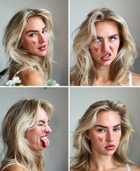 Influencer Ini Diejek Wajahnya Karena Punya Tompel di Muka, Beri Pesan Positif