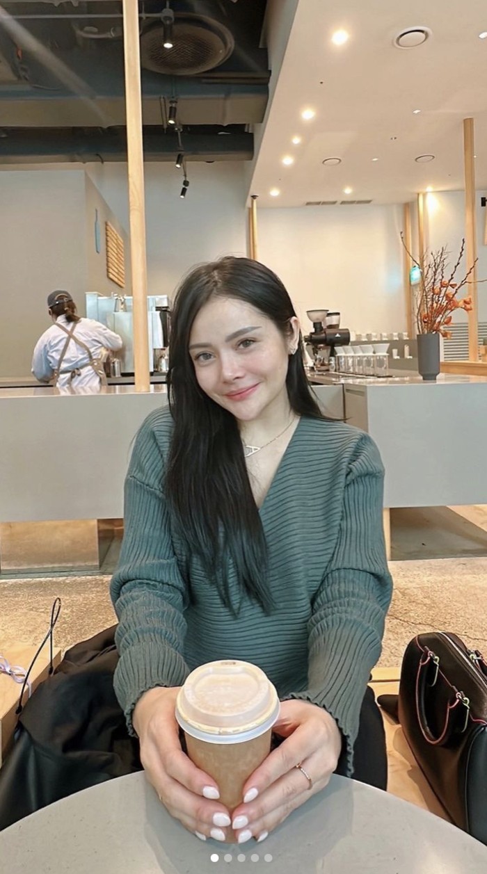 Selain Operasi Hidung, Mawar AFI Juga 'Cafe Hopping' Saat di Korea