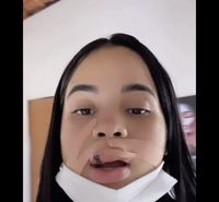 Influencer Ini Bibirnya Digigit Anjing Peliharannnya, Berakhir 10 Jahitan