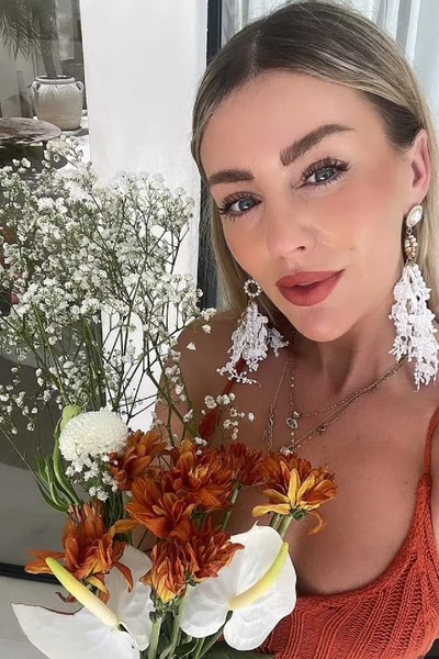 Bule Ahli Kecantikan Kecelakaan Horor di Bali, Nasibnya Viral Jadi Begini