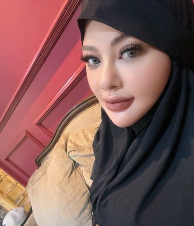 Potret Shindy Samuel Usai Turun BB 69 Kg Kini Pakai Hijab, Bikin Pangling