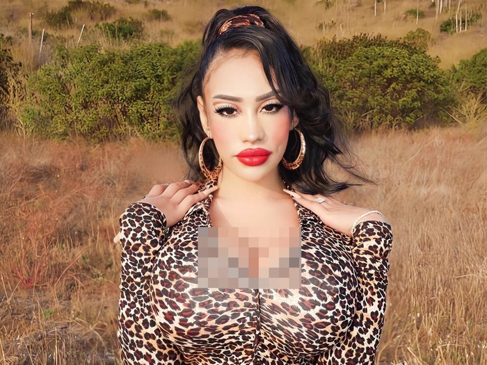 Model Terobsesi Jadi Wonder Woman Habiskan Rp 1,8 M, Tulang Rusuk Sampai Patah