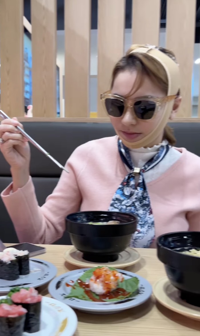 Maya Septha Oplas di Korea, Harus Lahap Makanan Lembut Saat Pemulihan