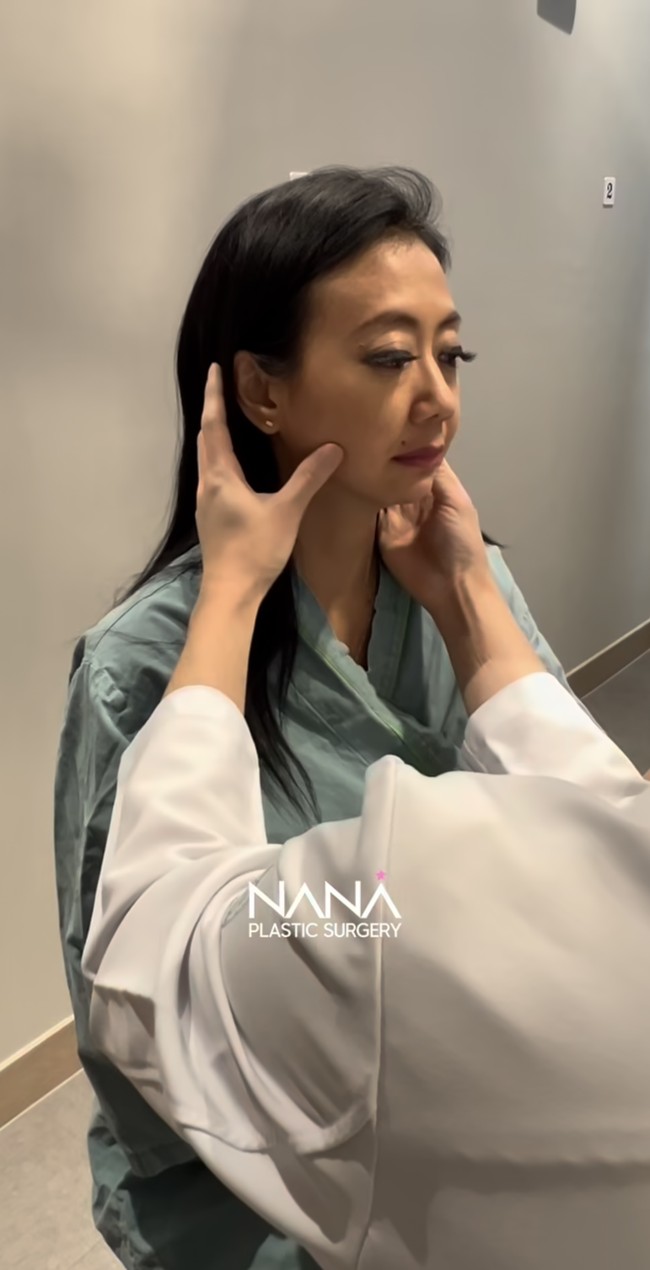 7 Potret Asri Welas Jalani Mommy Makeover, Oplas Bagian Wajah Hingga Tubuh