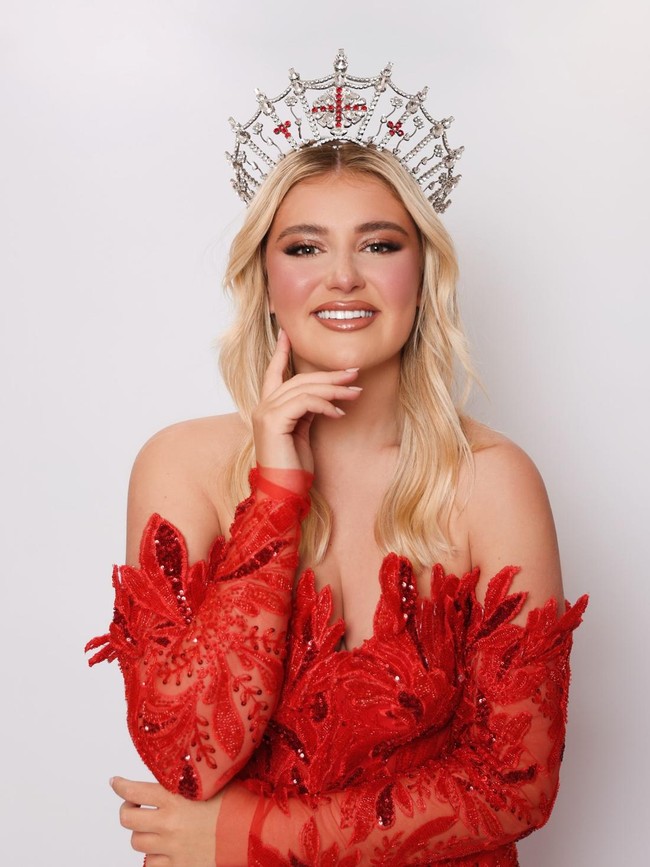 7 Foto Seksi Wulan Guritno Jadi Model Lingerie, Pamer Tubuh Langsing Bak ABG