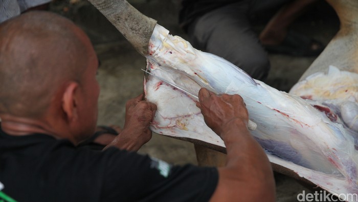 Mulai Waspadai Tanda-tanda Kolesterol Tinggi Meski Tak Selalu Mudah ...