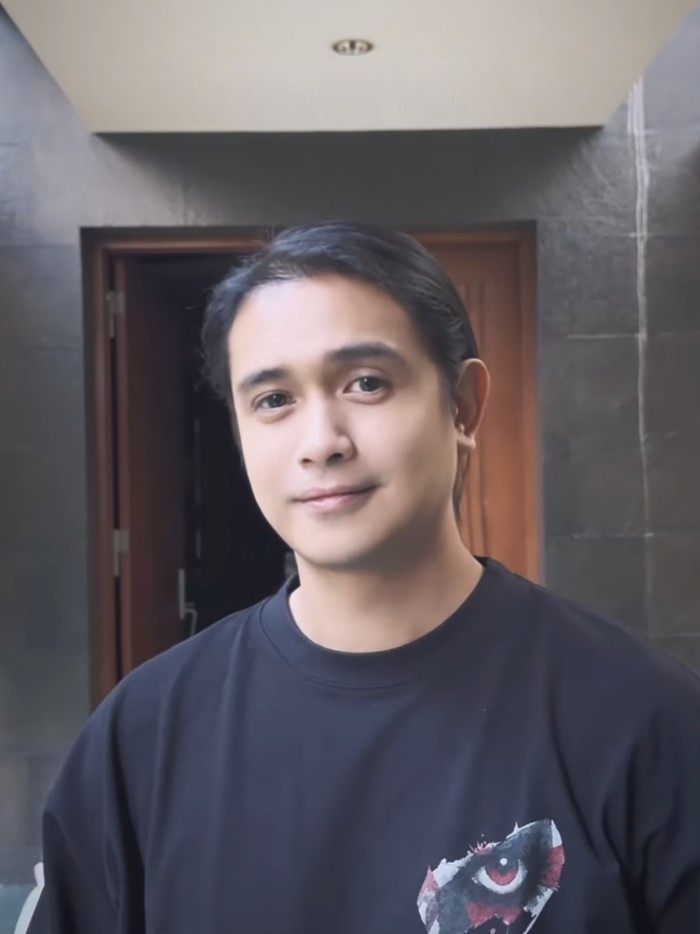 Penampilan Terkini Jennifer Ipel dan Ajun Perwira Oplas di Korea Selatan