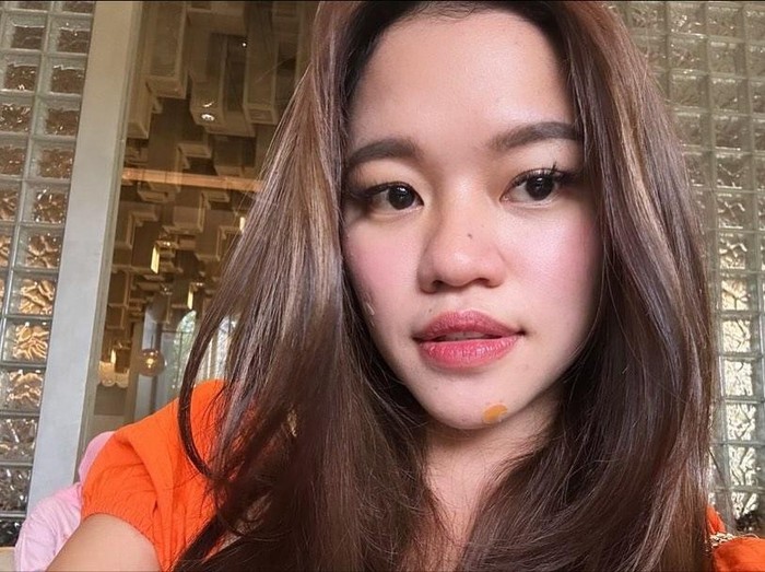 Ummi Quary Lagi Gacor Era, Ini Transformasi Tanpa Oplas